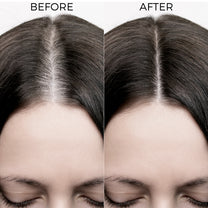 Brillare Rosemary Oil Shots Pack of 2 with Root Deep Scalp Food for ...