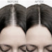 Complete Hair Fall Control kit – Brillare